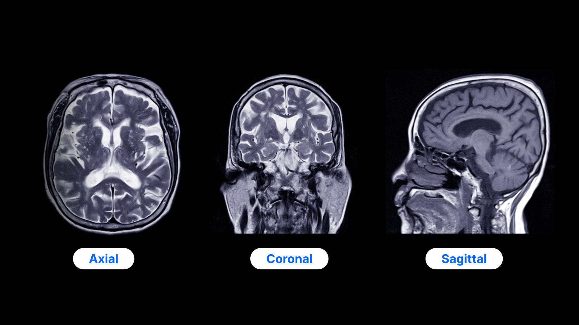 How to Read MRI Results: Interpreting Your Report & Terminology