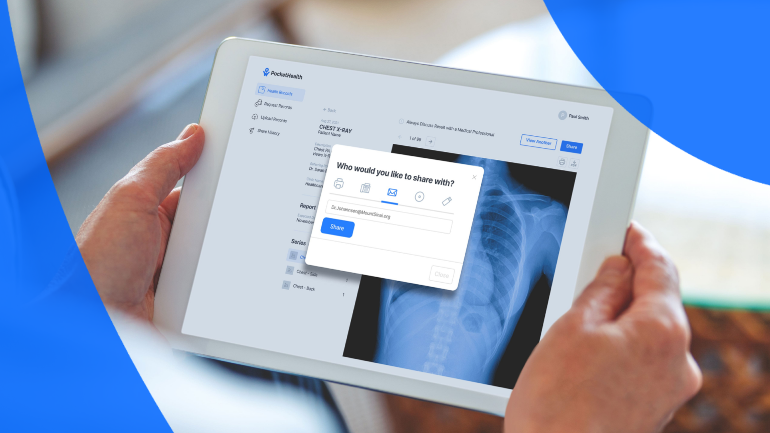 How to Read an X-Ray Report: Lucency, Acute Osseous Abnormality & More