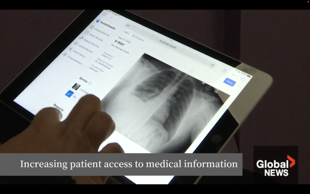 Global News: PocketHealth helps caregiver find a better treatment plan ...