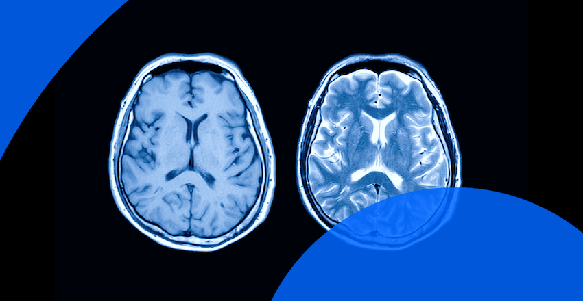 How Long Do Mri Results Take How To Check My Report Online