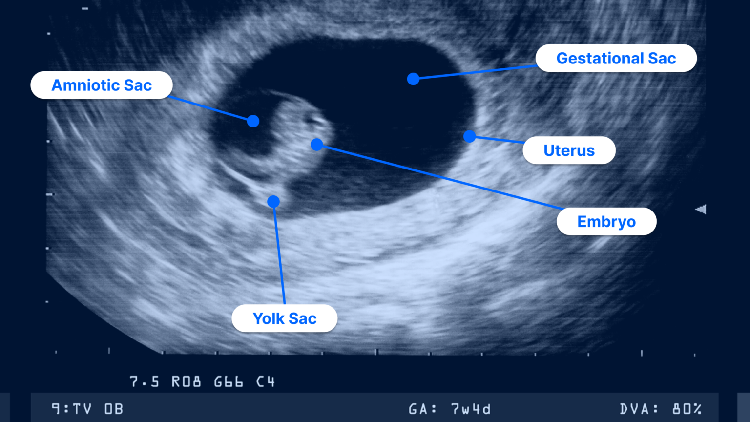 How to Read an Ultrasound: Colors, Numbers and Abbreviations