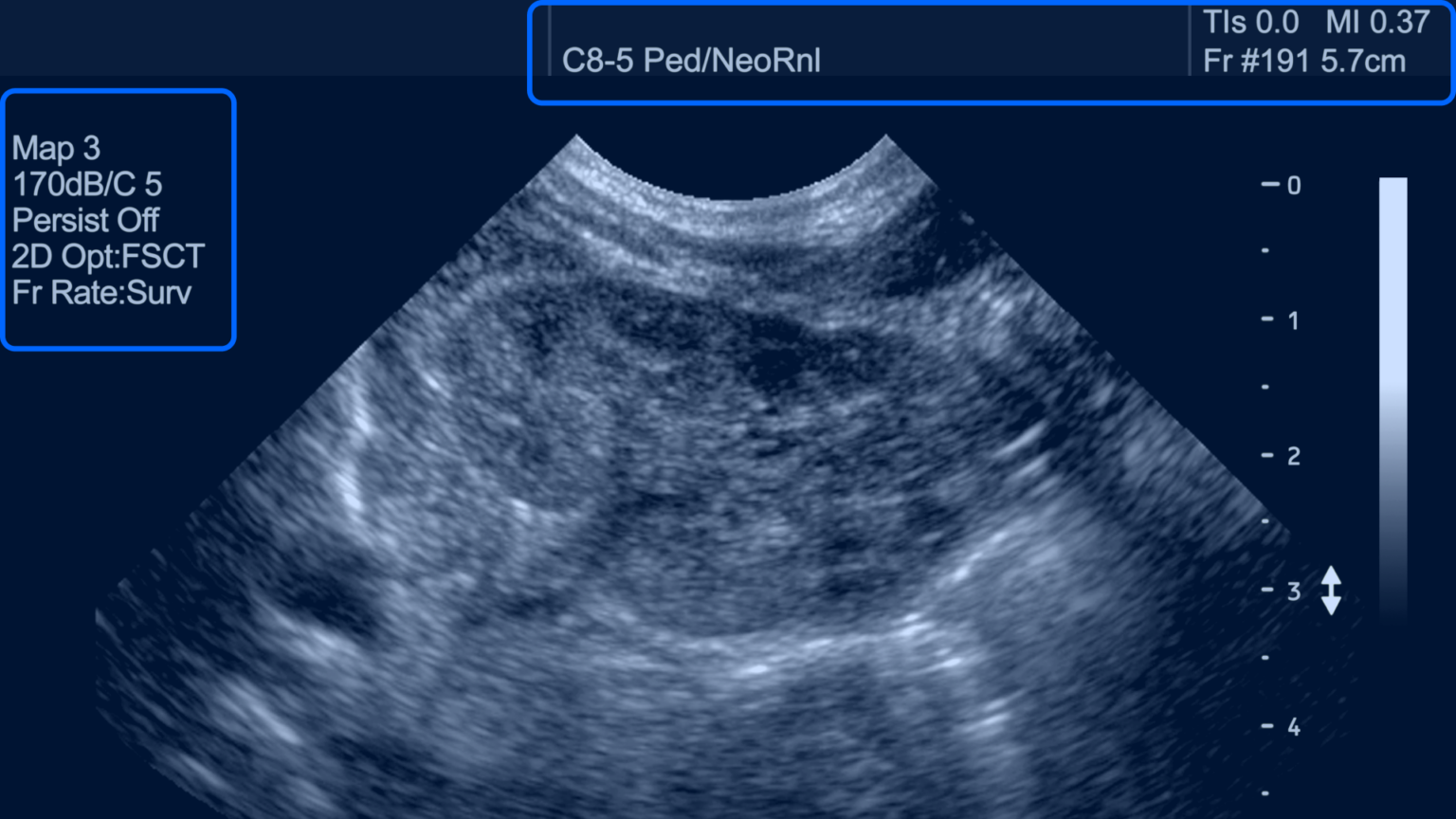 How to Read an Ultrasound: Colors, Numbers and Abbreviations