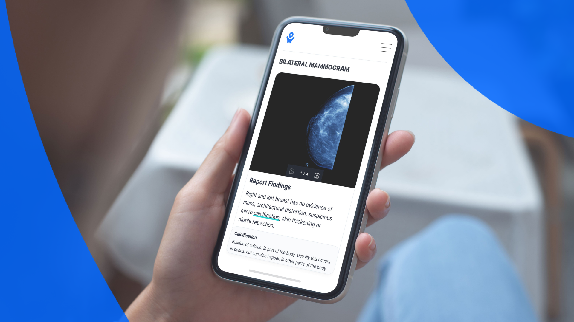 How to Read Mammogram Results: BI-RADS, Asymmetries & More