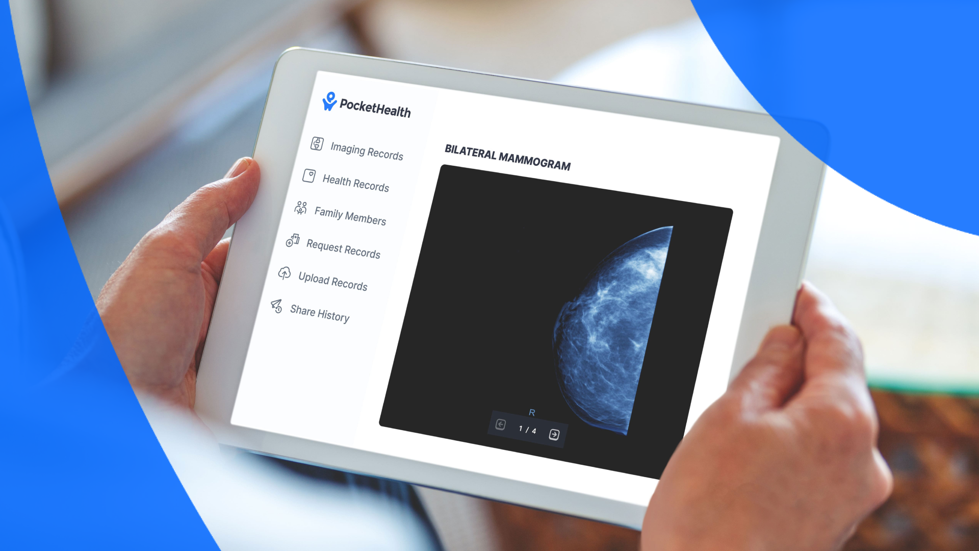 How to Read Mammogram Results: BI-RADS, Asymmetries & More