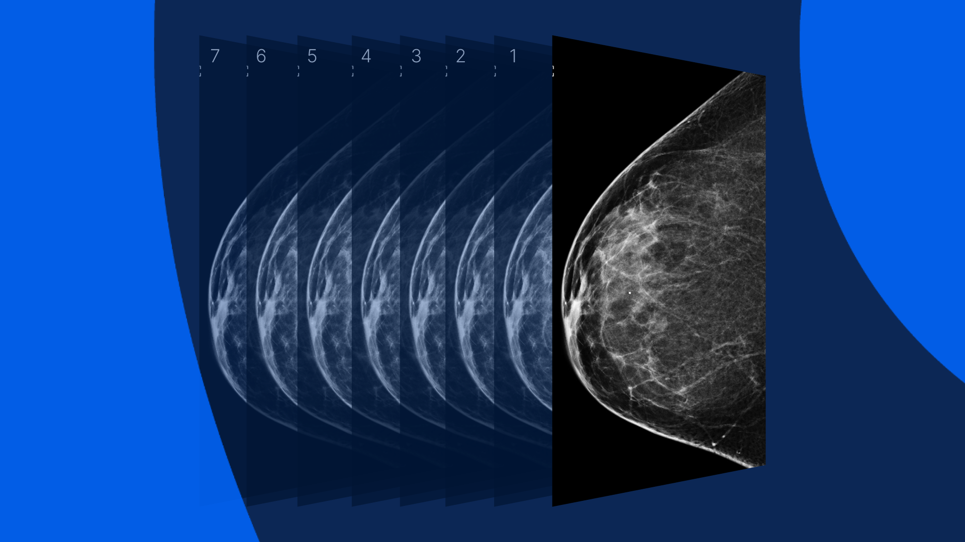2D vs 3D mammogram: How they compare and what to expect